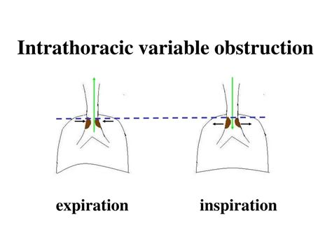 Ppt The Pathophysiology Of Respiratory Failure Powerpoint