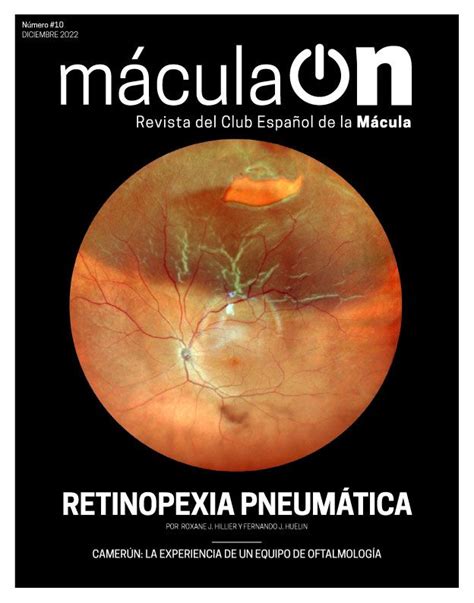 Roxane Jo Hillier Posted On Linkedin