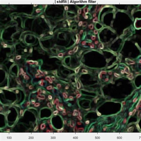 Use The Filter Stdfilt The Segmented Image Shows The Result Of