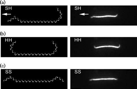 Cell Shape And Movement Of Leptospira A Swimming Form Showing