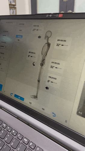 거북목 라운드숄더 통증완화를 위한 일산 화정 체형교정 다인체형관리 체험 후기 네이버 블로그