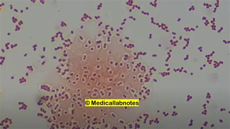Acinetobacter Introduction Morphology Pathogenicity Lab