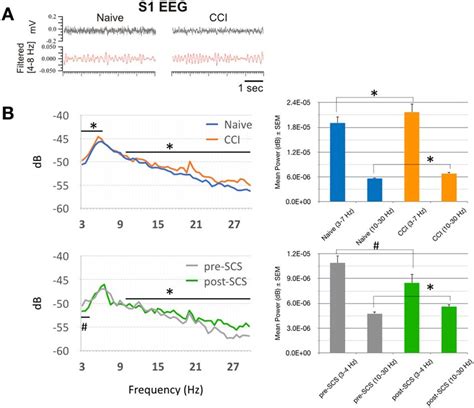 A EEG Waveforms Traces Show Representative EEG Recordings From One Download Scientific