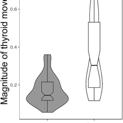Violin Plot Showing Distribution And Notched Boxplot With Median Download Scientific Diagram