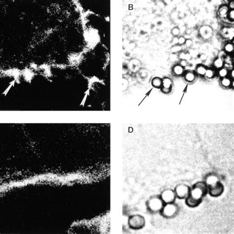Analysis Of Fcγr Mediated Phagocytosis By Phase Contrast And Confocal