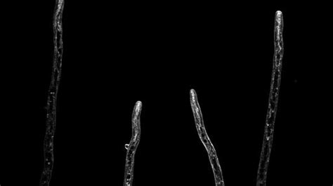 Strands Of Mycelium Growing Under A Microscope Aspergillus Fumigatus