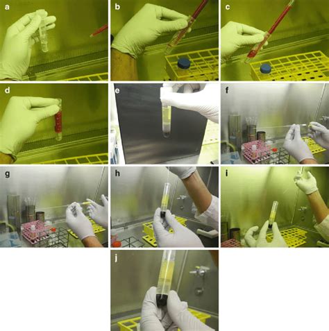 Extraction Of Bone Marrow Mononuclear Cells Bmmnc By Ficoll Gradient Download Scientific