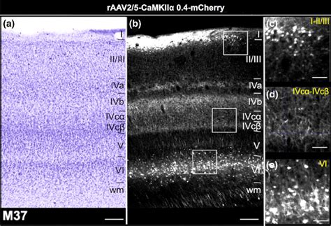 Transduction Patterns In V1 For Raav25 Camkiiα04 A And B