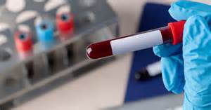 Viremia Residual Del Vih Por Qué El Virus Persiste En Algunos