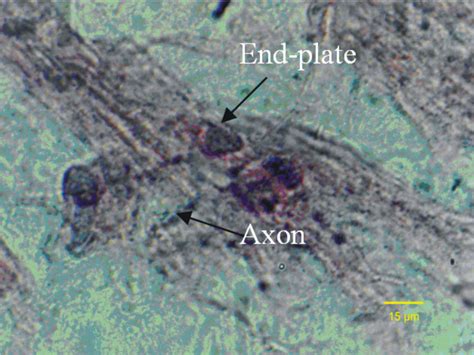 Only One Axon Reaches The End Plate Download Scientific Diagram