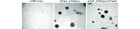 Expression Of Egfr Exon 19 Deletion Mutants In Nih 3t3 Cells Enables