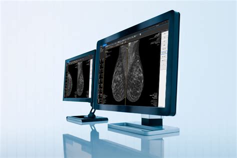 Hanging Protocols In Radiology Blog Nestopiaa