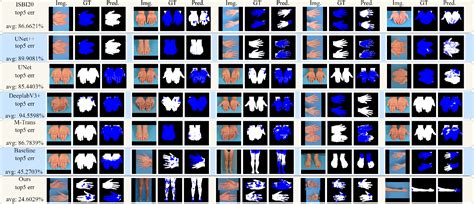 Figure 7 From Bridging The Gap Between Vitiligo Segmentation And Clinical Scores Semantic Scholar