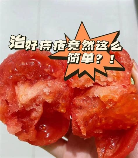 如何1个月轻松除痔？这篇文章一定要阅读完！秘诀原来是这样！ 知乎