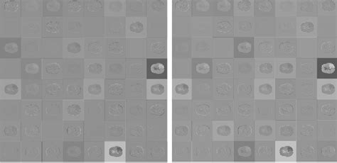 Figure 1 From Lbts‐net A Fast And Accurate Cnn Model For Brain Tumour