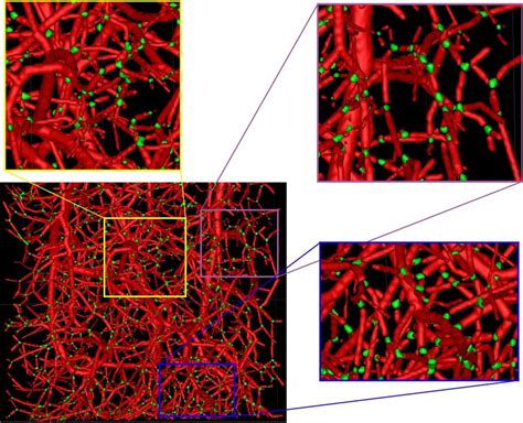 Bifurcation Detection On Synthetic Test Data Using Deepvesselnet Fcn