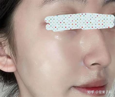 养成好皮肤好像并不复杂 知乎
