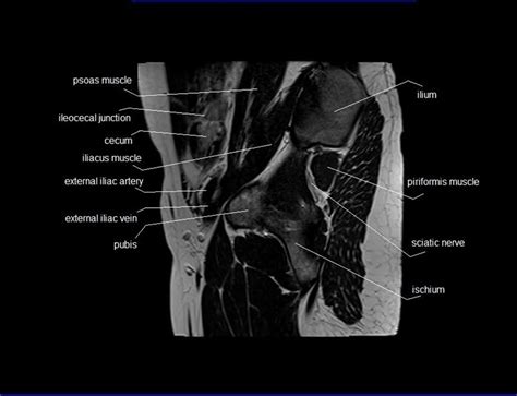 Male Pelvis Anatomy