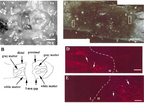 The Complete Transection At T8 Spinal Cord A The 5 Mm Gap And Download Scientific Diagram