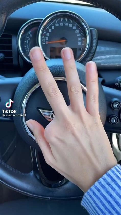 Finger Amputee Stump