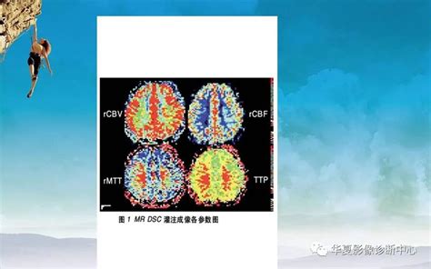 磁共振灌注成像临床应用 医学界 助力医生临床决策和职业成长