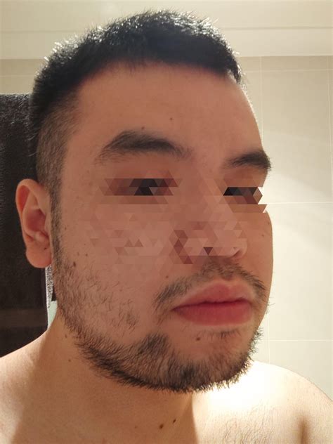 Should I Shave My Facial Hair 10 Days Of Growth R Malegrooming