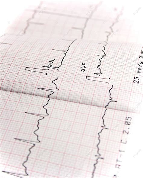 Electrocardiogram Wave Wave Ekg Photo Background And Picture For Free