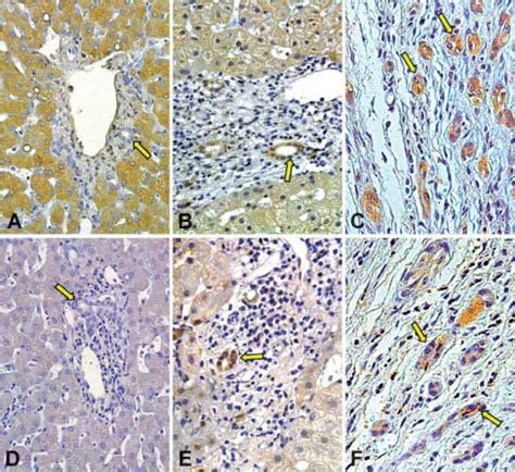 Immunohistochemistry For Igf 1 And Igf1 R In Liver Section Of Normal