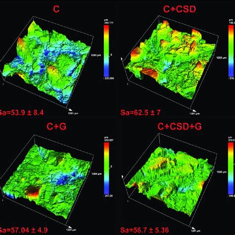 Surface Topography Of The Synthesized Biomaterials Visualized By Laser