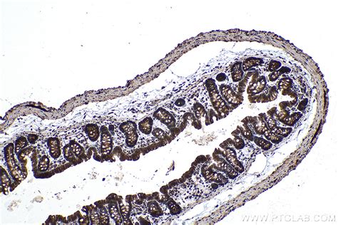 IHCeasy RTCB Ready To Use IHC Kit KHC0860 Proteintech