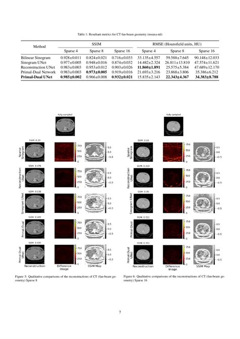 Sinogram Upsampling Using Primal Dual Unet For Undersampled Ct And