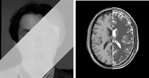 Figure 1 From Entropic Graphs For Registration Semantic Scholar