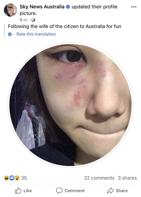 Toilet Paper Australia On Twitter Bro Sky News Facebook Has Been