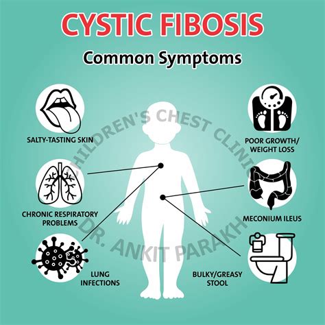 Unbelievable Info About How To Diagnose Cystic Fibrosis Displaybehalf6