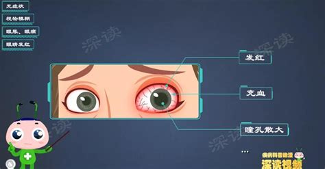 视物模糊畏光流泪细数第二大致盲眼病青光眼致盲前有啥征兆 知乎