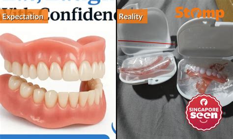 ‘toothless Man Angry After Getting ‘fake 29 Dentures He Bought