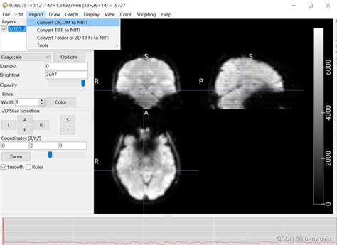 使用spm预处理fmri数据fmri中的tr是什么意思 Csdn博客