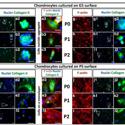 Immunofluorescence Staining For Collagen Type Ii A1 F3 Collagen Type
