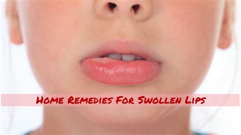 How To Get Rid Of Swollen Lips Using Home Remedies