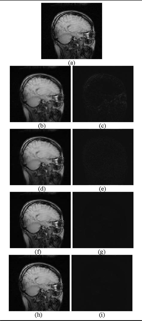 figure 4 from mri denoising using pixel selection based non local means semantic scholar