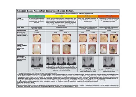 Caries Classification