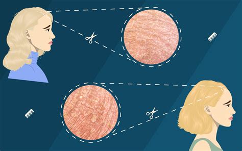 How To Treat Scabs On Scalp From Bleach Step By Step