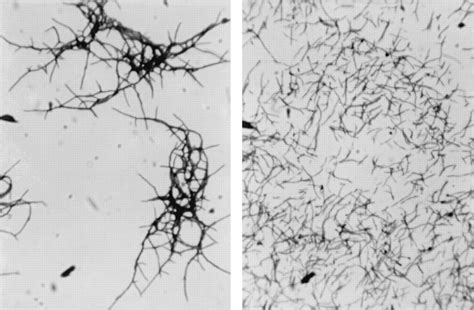 Eritromicina Museu do Universo da Farmácia