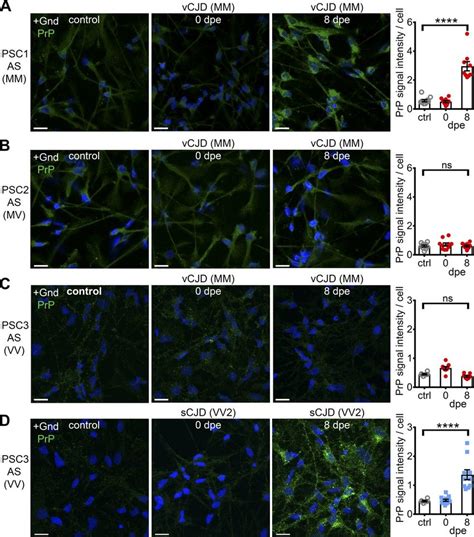 Human Ipscderived Astrocytes Accumulate Prpsc When The Cjd Inoculum Download Scientific