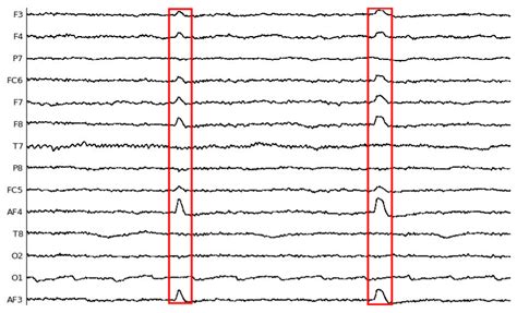 The Red Frames Show The Noticeable Effect Of Eye Blinking In The Eeg