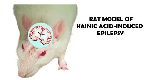 Assessment Of Anti Epileptic Efficacy Of Herbal Formulations In A Rat