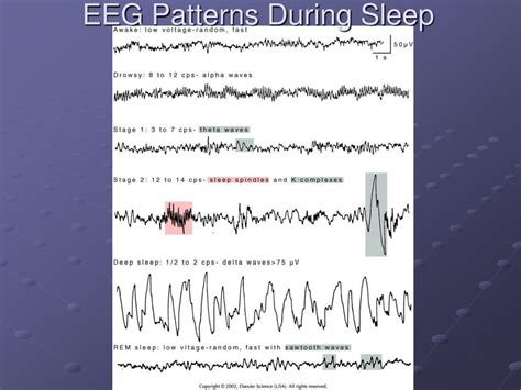 PPT EEG Patterns During Sleep PowerPoint Presentation Free Download ID 3367784