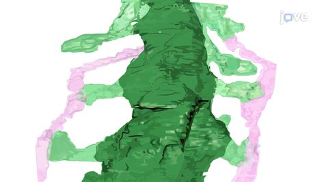 Video Focused Ion Beam Scanning Electron Microscopy For 3d Reconstruction Of Synaptically