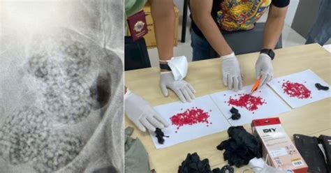 갑자기 발작하며 분홍색 액체 쏟아내위장 속 가득한 이것 때문