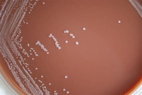 Free Picture Photograph Colonial Morphology Gram Negative Brucella Abortus Bacteria